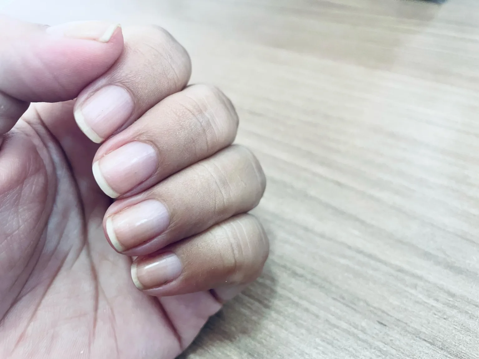 Unhas fracas? Entenda os motivos que causam unhas quebradiças - Folha BV